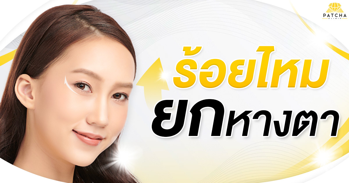 ร้อยไหมยกหางตาคืออะไร ดีไหม เหมาะกับใครบ้าง